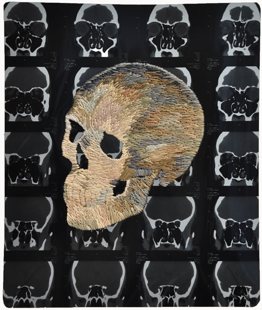 Embroidered X-Rays by Matthew Cox - Make: